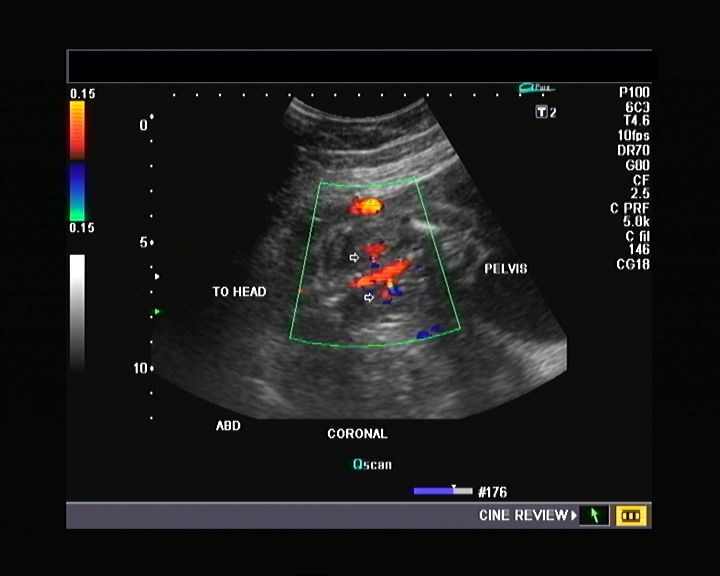 Daily Dx: A Simple Fetal Quiz