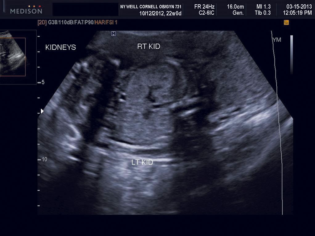 Ultrasounds images: Fetal anomalies of the first and second trimesters ...