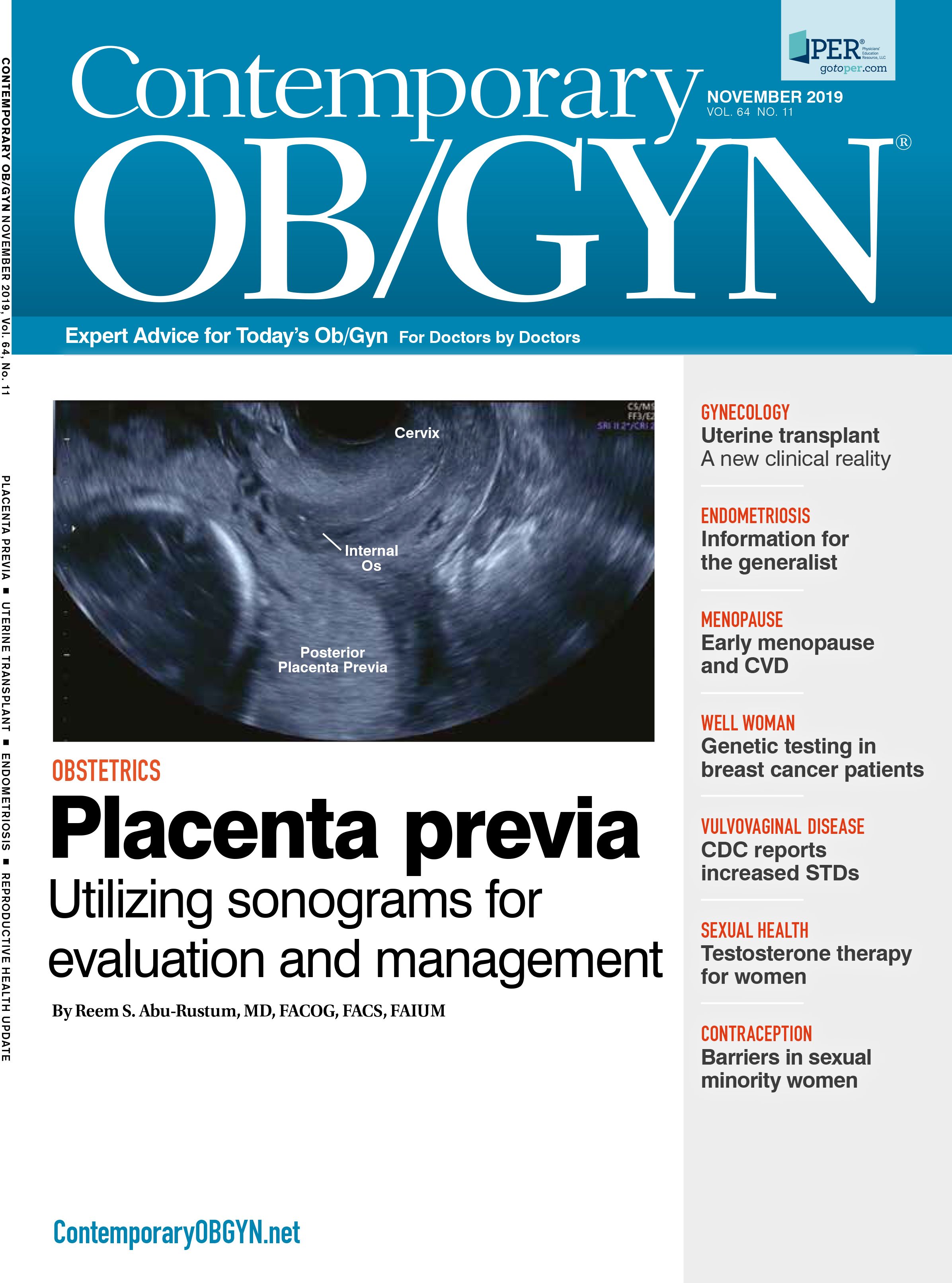 Placenta Previa Practical Approach To Sonographic Evaluation And