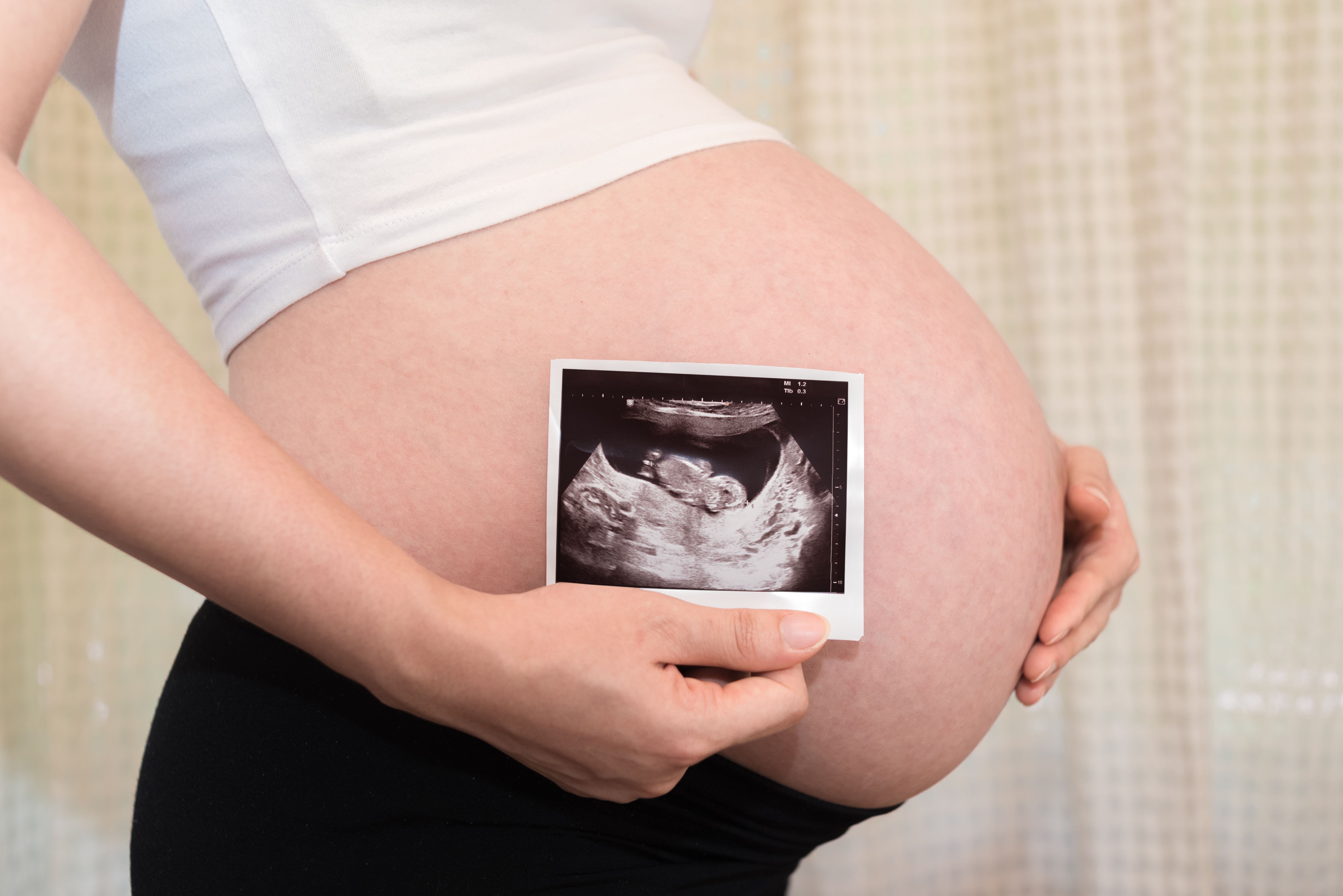 Noninvasive Prenatal Screening In Twin Pregnancies noninvasive-prenatal-screening-in-twin-pregnancies