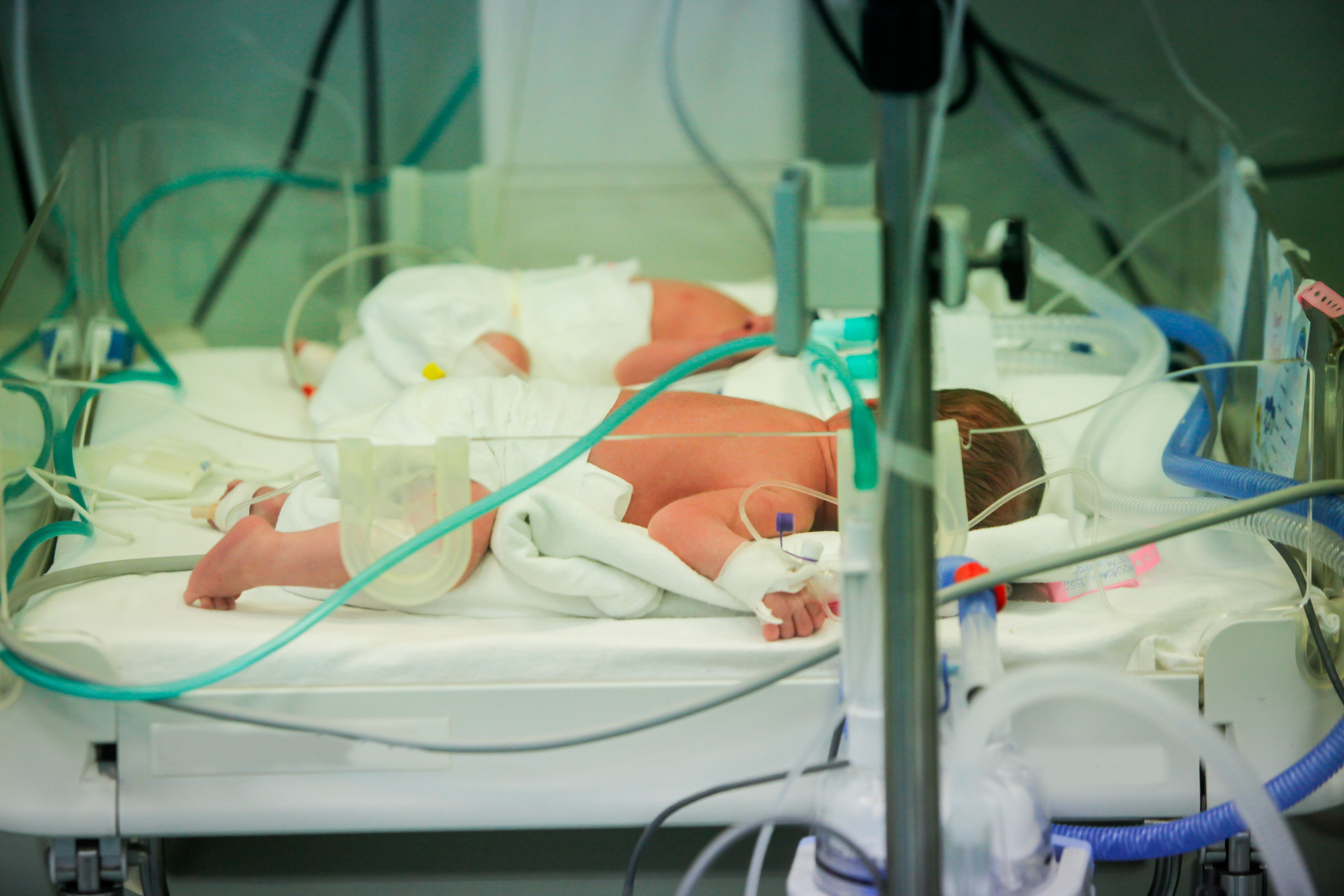 Outcomes of extremely preterm birth