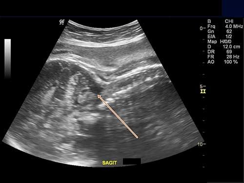 Image IQ: Third Trimester Fetal Brain | Contemporary OBGyn