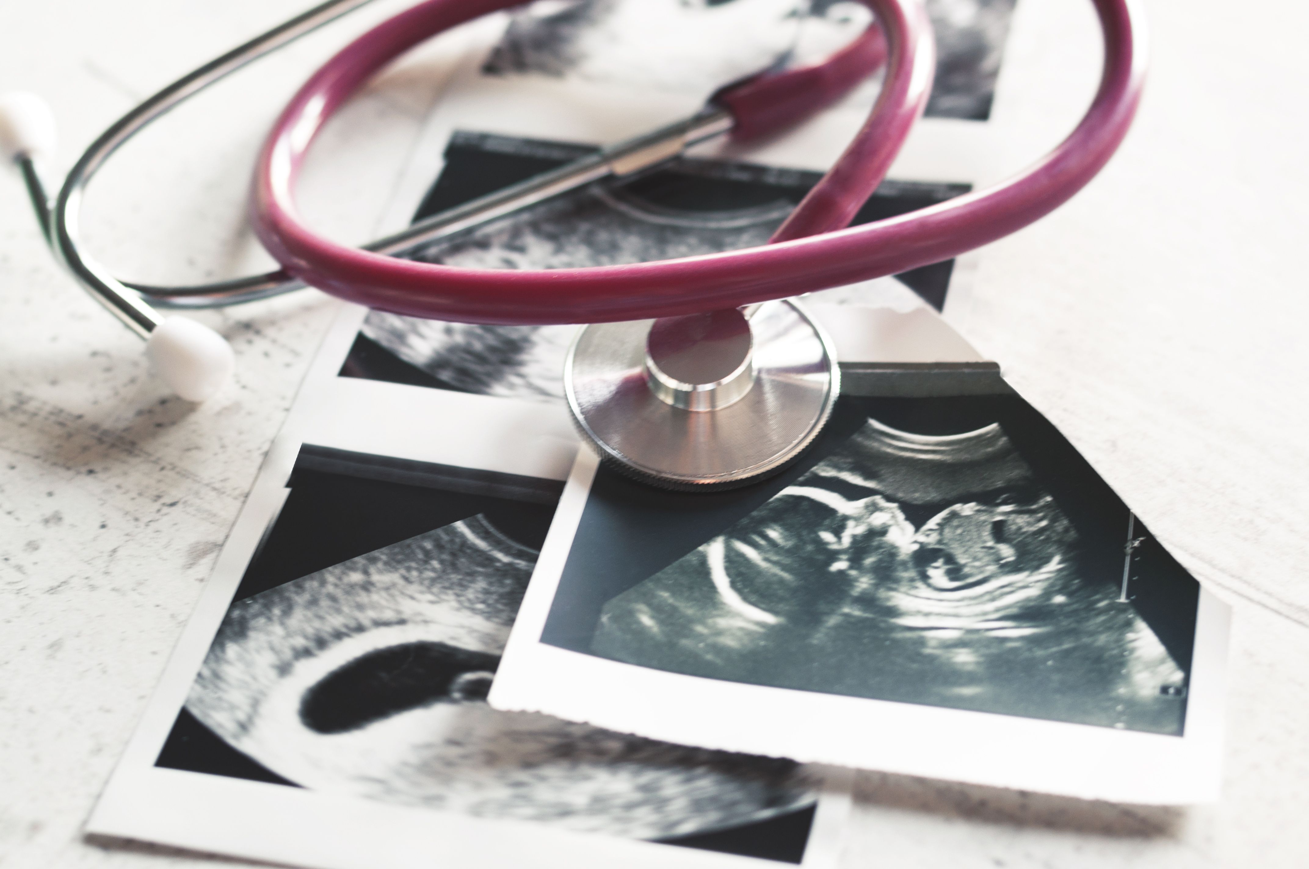Reducing the stigma of unplanned pregnancy starts with a conversation