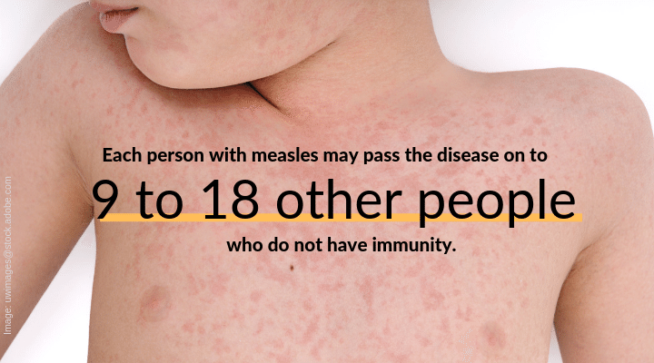 10 measles facts to share with parents