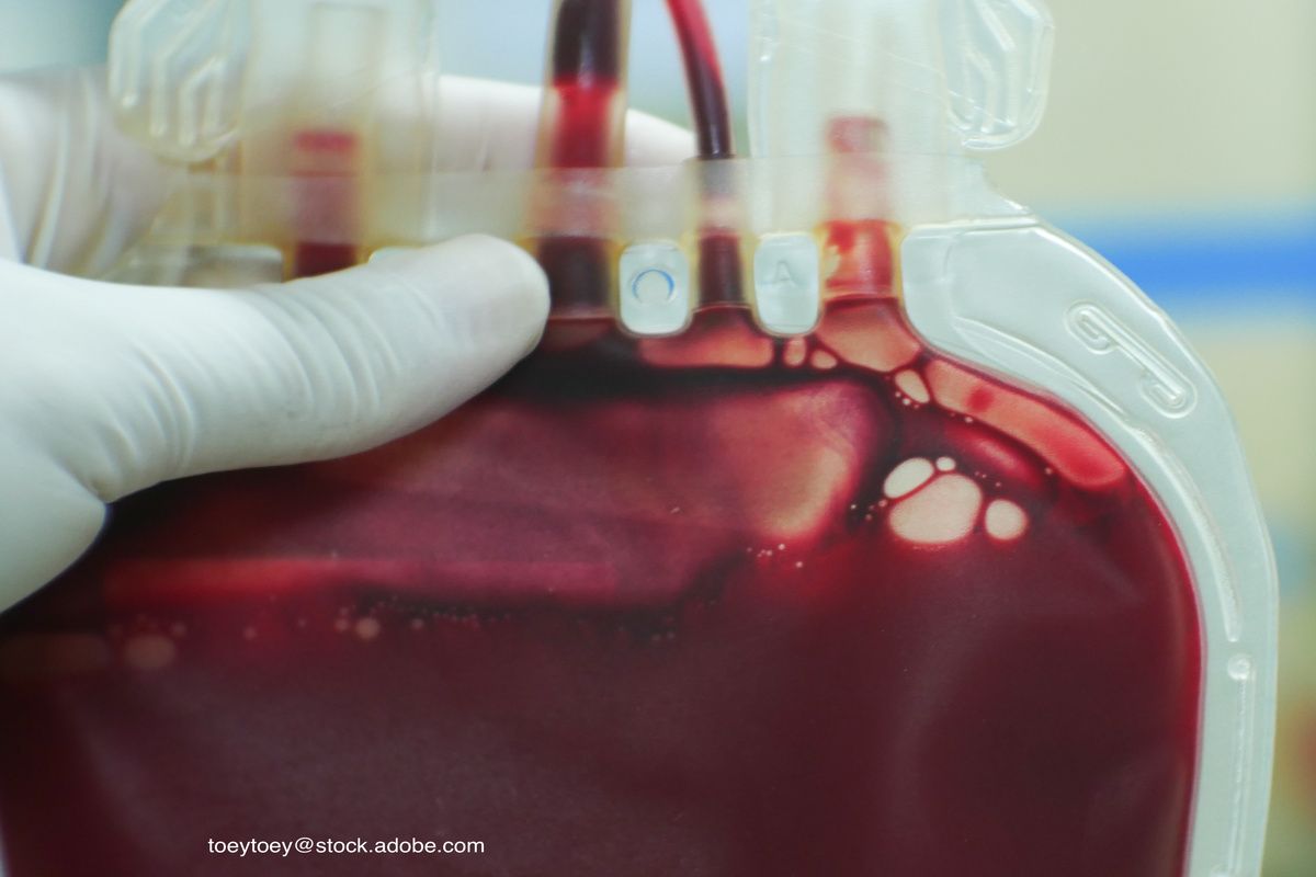 Impact of preoperative blood transfusion on postoperative outcomes in ...