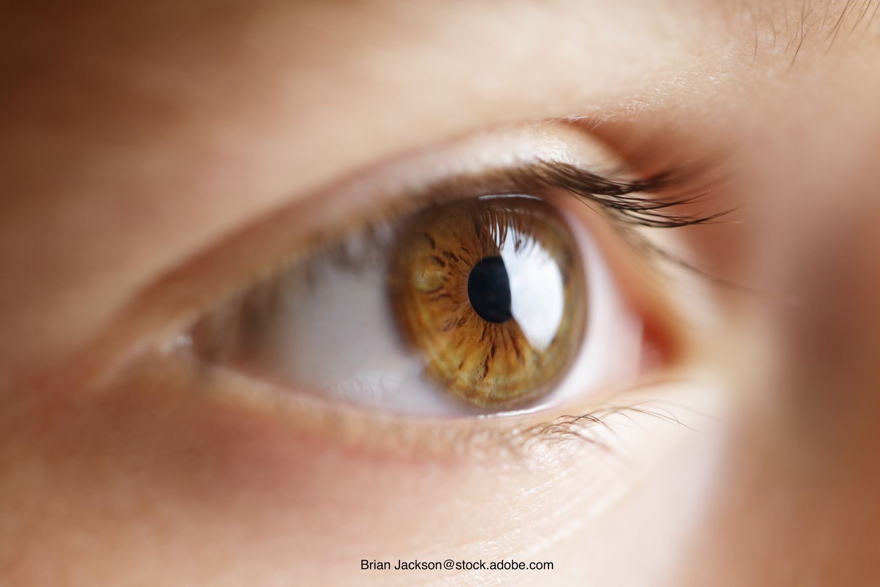 How good are the outcomes of lensectomy to treat traumatic cataract?