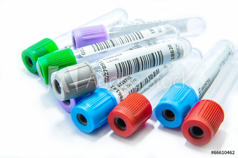 To test or not to test