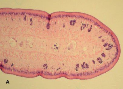 Fish Tapeworm Infestation