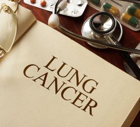 Augtyro ‘Fills a Gap’ in the Treatment of ROS1-Positive NSCLC | CURE