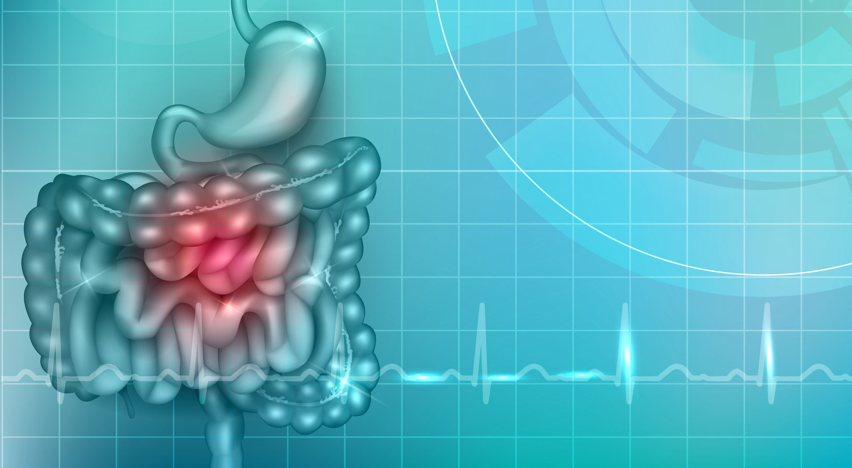 Expert Discusses Exciting Advancements in Treating GI Cancers