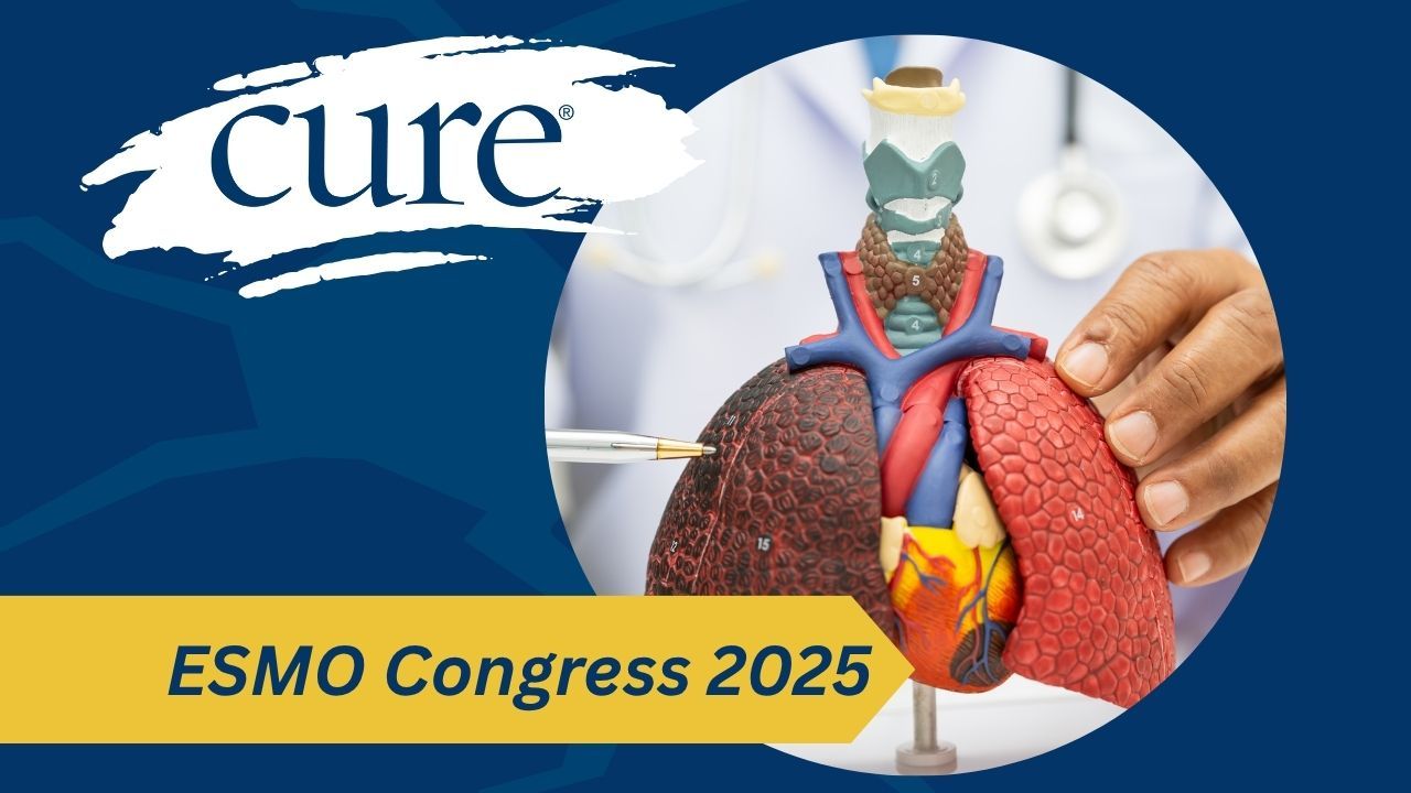 Imdelltra Plus Chemoimmunotherapy Safely Elicits Responses in ES-SCLC ...