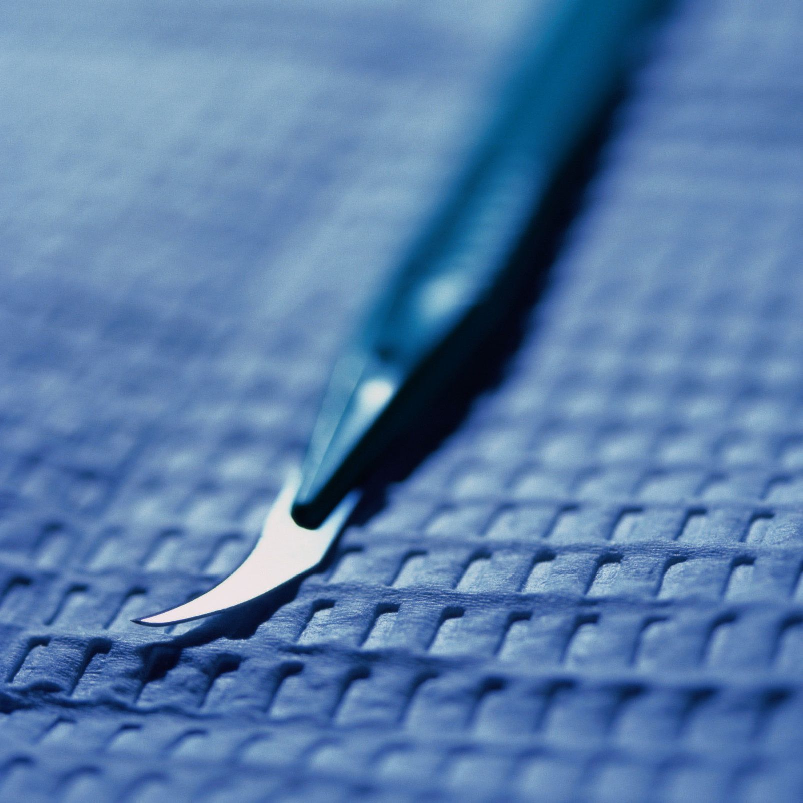 New Guideline Clarifies Surgical Margins in Treating Breast Cancer