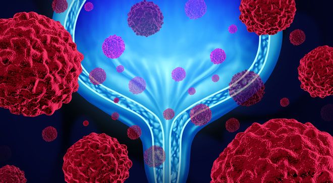 Keytruda May Play a Role in Treatment of Patients with Non-Muscle ...