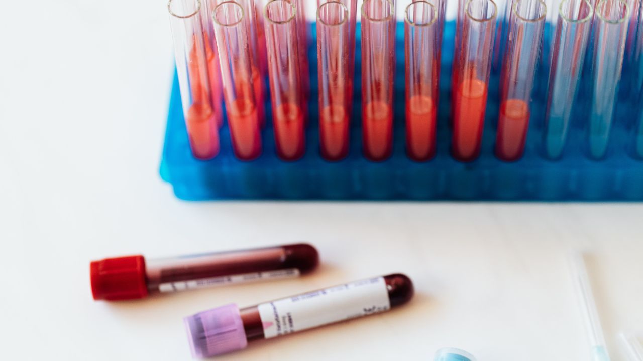 Signatera May Predict Recurrence in Anal, Rectal Cancers | CURE