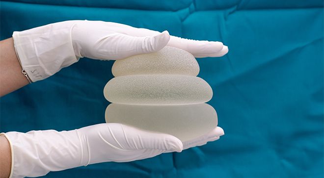 Breast Implant-Associated Anaplastic Large Cell Lymphoma: Symptoms ...