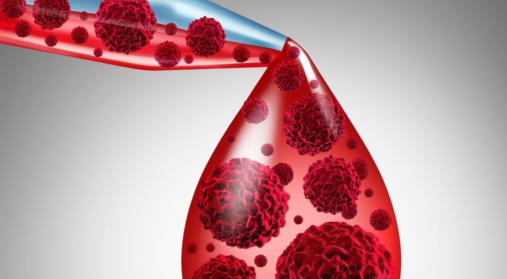 Results From the Phase 2 CAPTIVATE Study | CURE