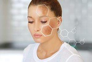 Characteristics that distinguish facial hyperpigmentation disorders