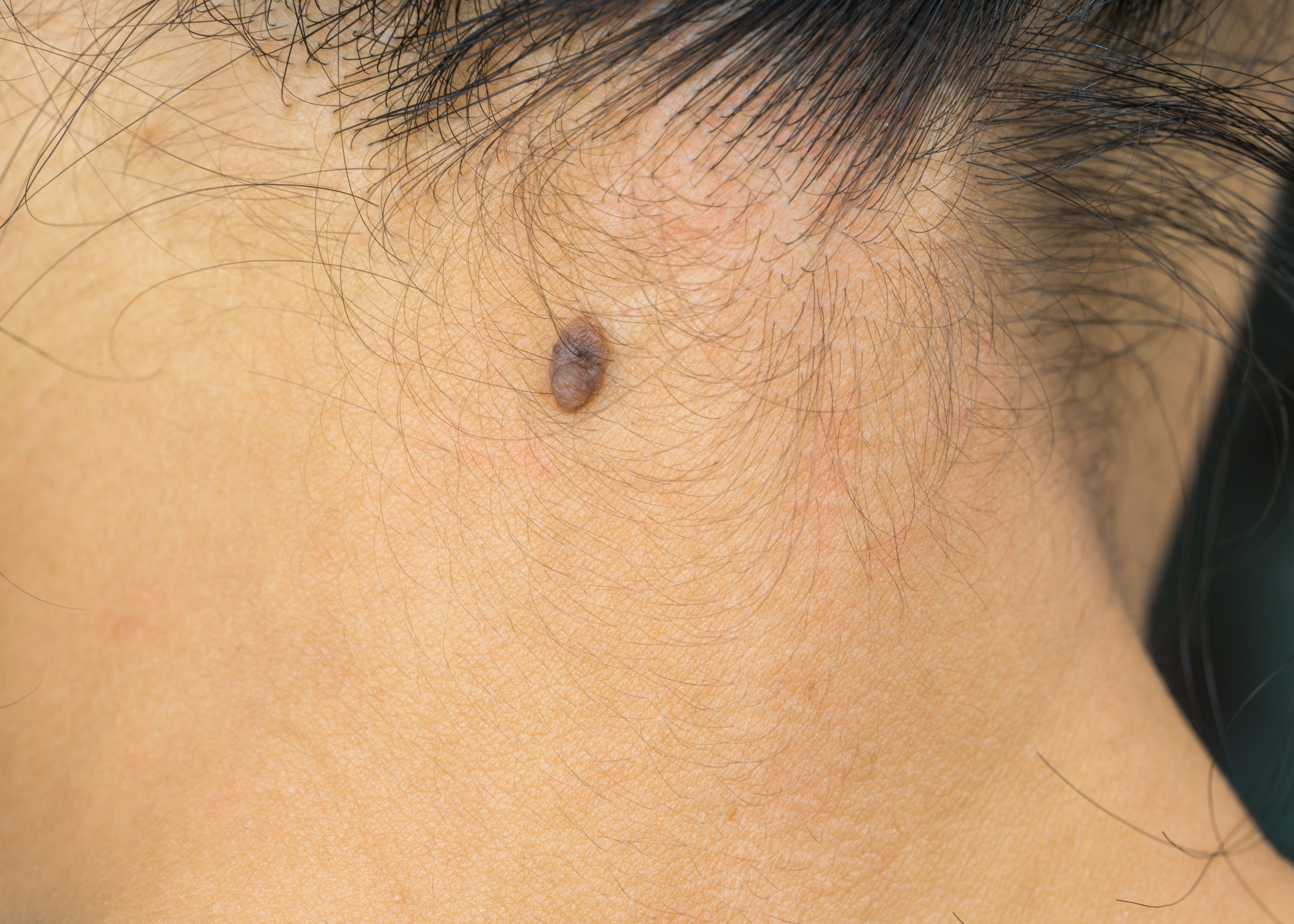 Asian American and Pacific Islander Patients Face Increased Odds of ...