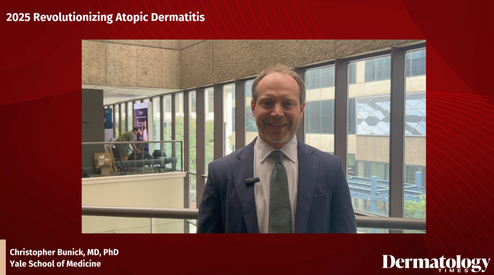 OX40/OX40L Inhibitors Offer Upstream Signaling Pathways in Atopic ...