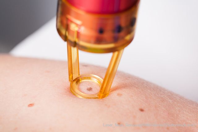Medical device regulation impacts patient care | Dermatology Times