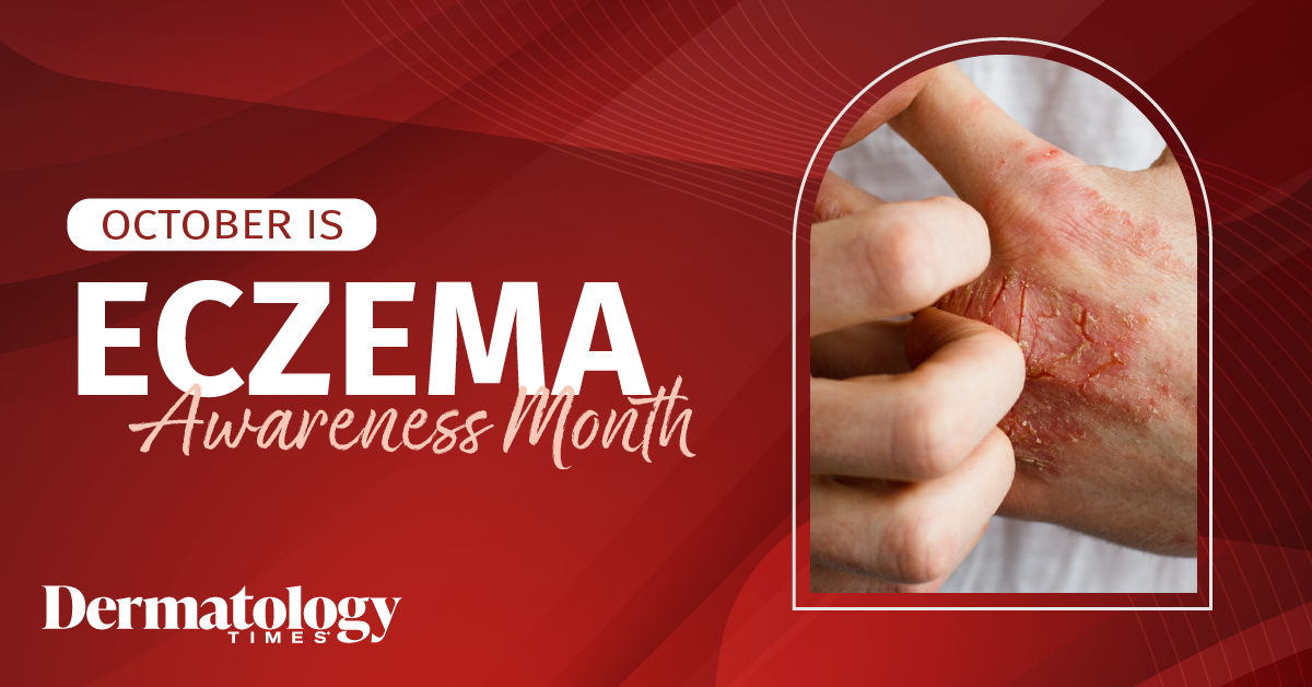 Celebrating Eczema Awareness Month 2025 with Dermatology Times ...