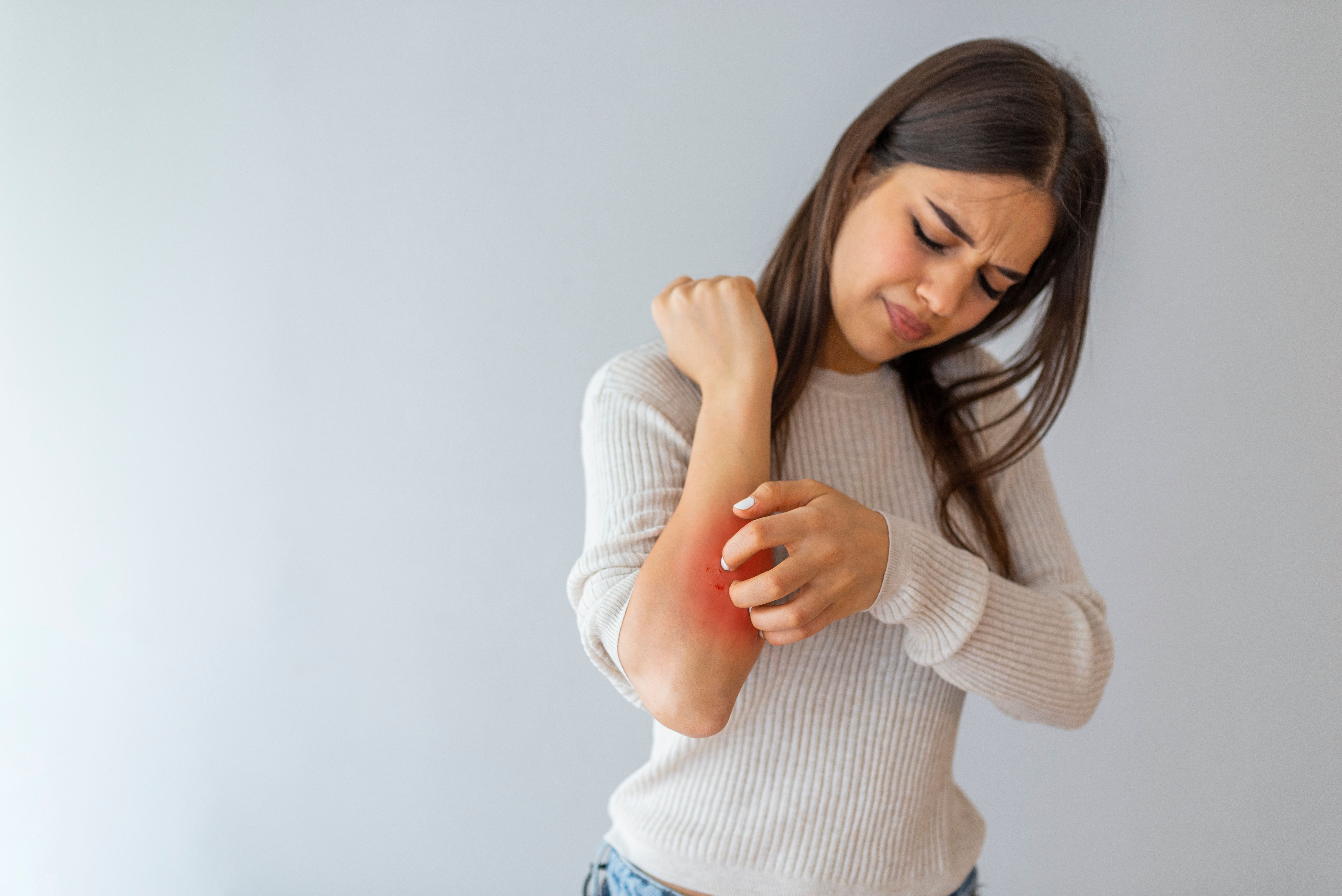Lanolin Named Allergen Of The Year