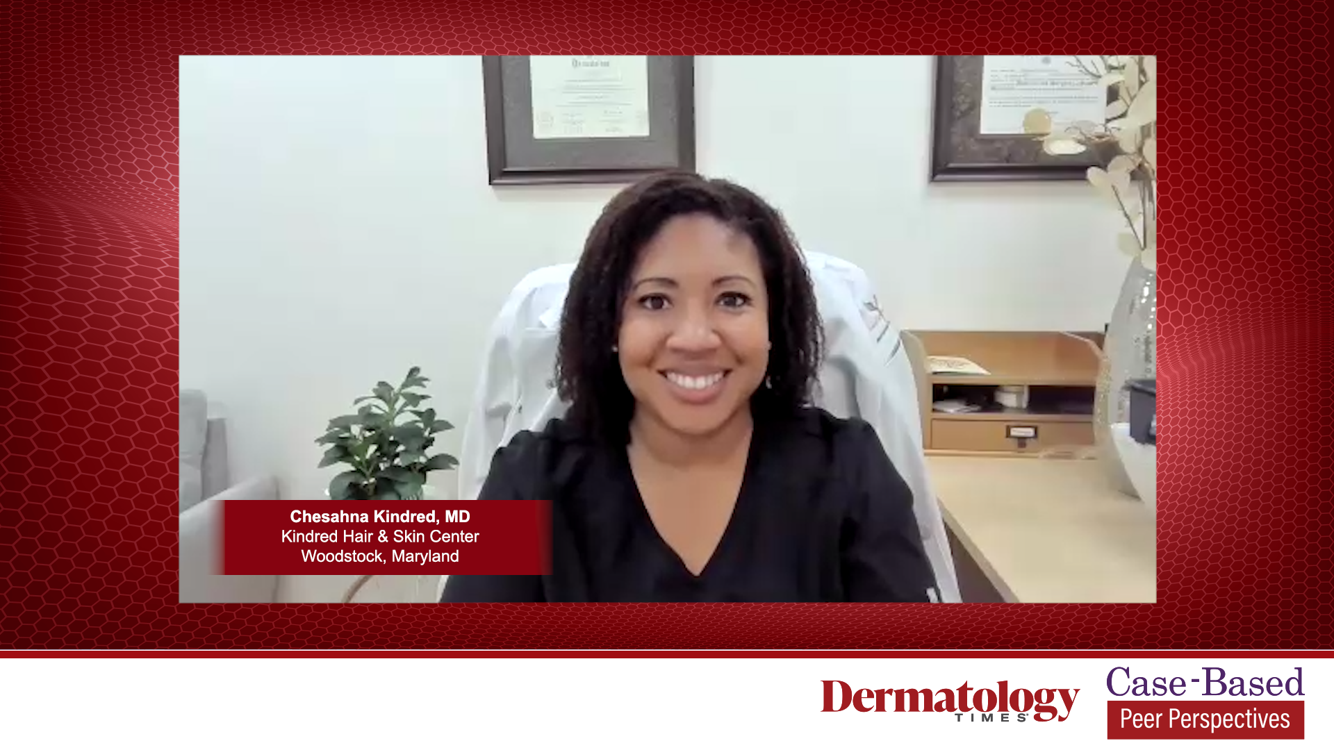 Advanced Vitiligo Care: Strategies for Facial Involvement and Difficult ...