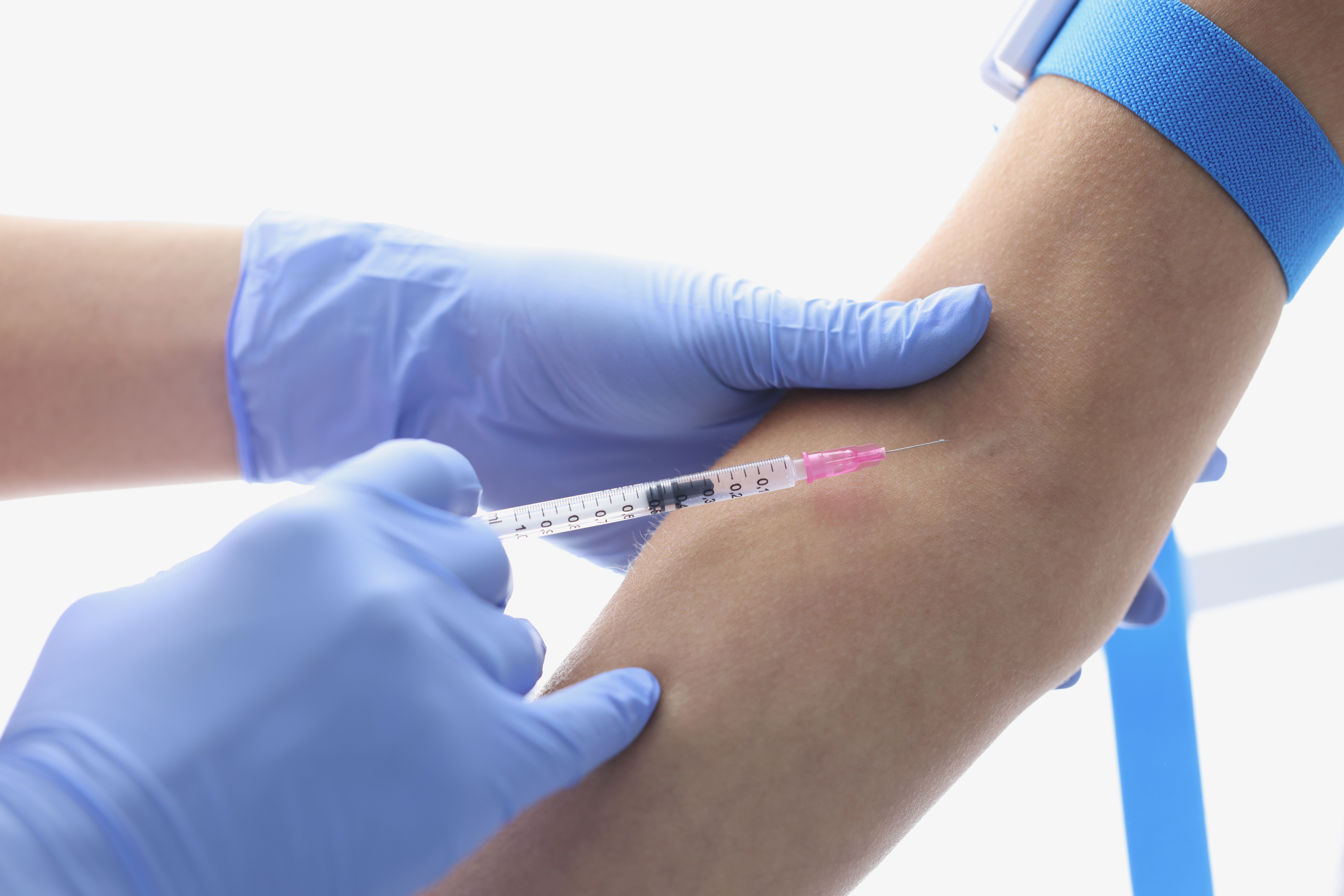 Phase 3 Trial Shows Intravenous Immune Globulin Effective For Dermatomyositis