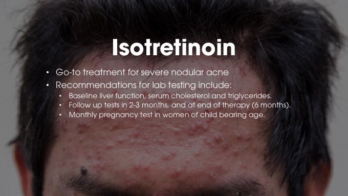 Acne treatment guidelines at a glance