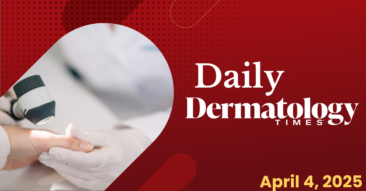 Daily Derm Times: April 4, 2025 | Dermatology Times