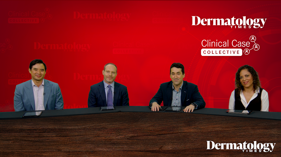 Clinical Experience and Diagnosis of GPP