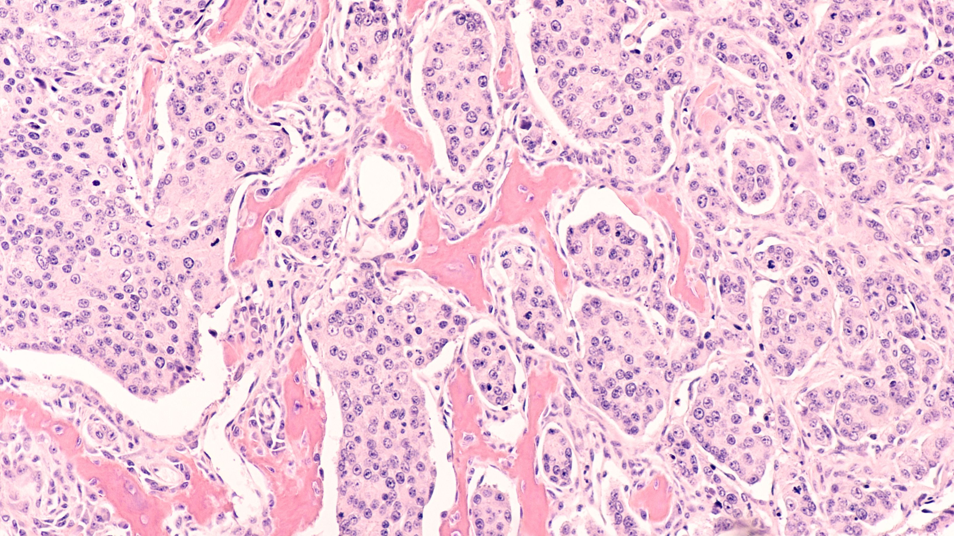 SCC and BCC Updates from Maui Derm NP+PA Fall