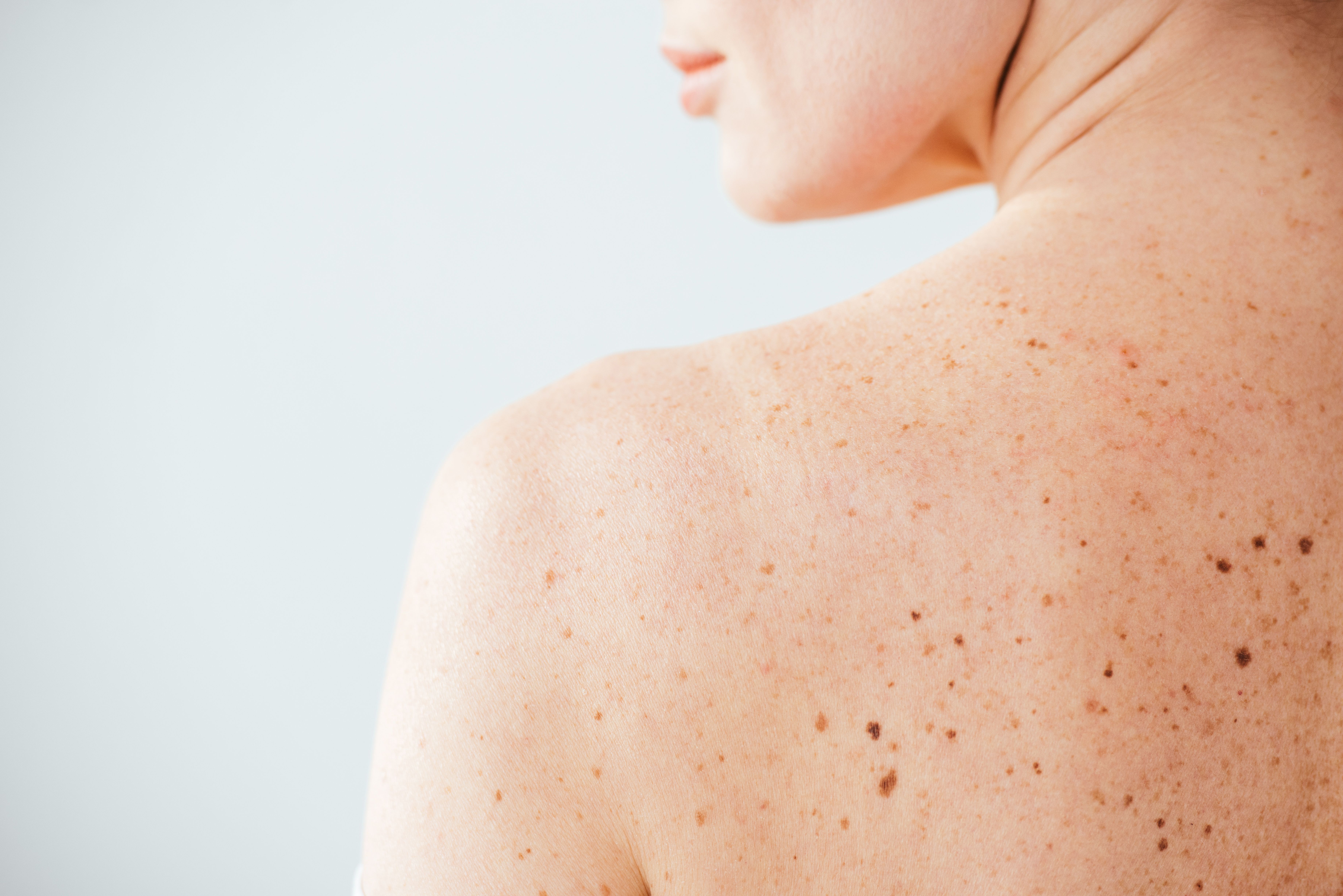 Dermatologists’ Role in Breast Cancer Awareness and Survivorship ...