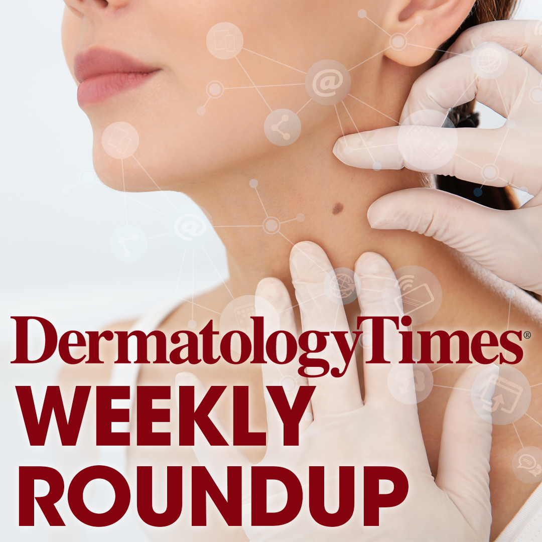 Weekly Roundup: June 22-26 | Dermatology Times