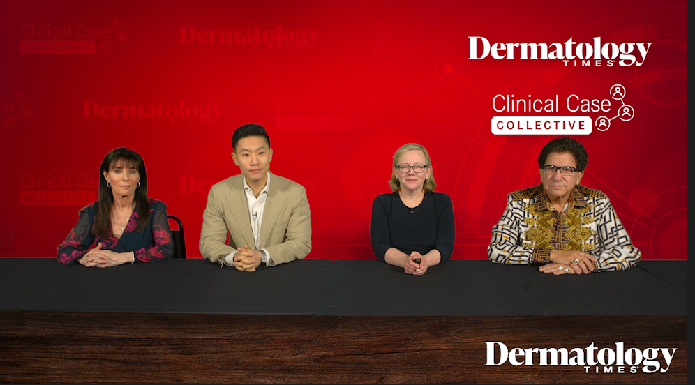 Determining Atopic Dermatitis Severity and When to Advance to Systemic ...