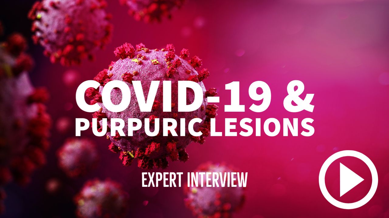 This skin lesion may signal severe disease in COVID-19 patients ...