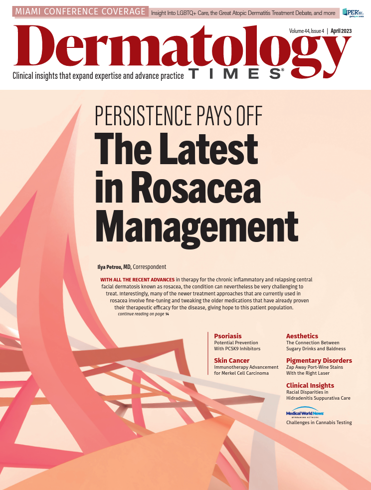 Tirbanibulin Improves Skin In Patients With Actinic Keratosis