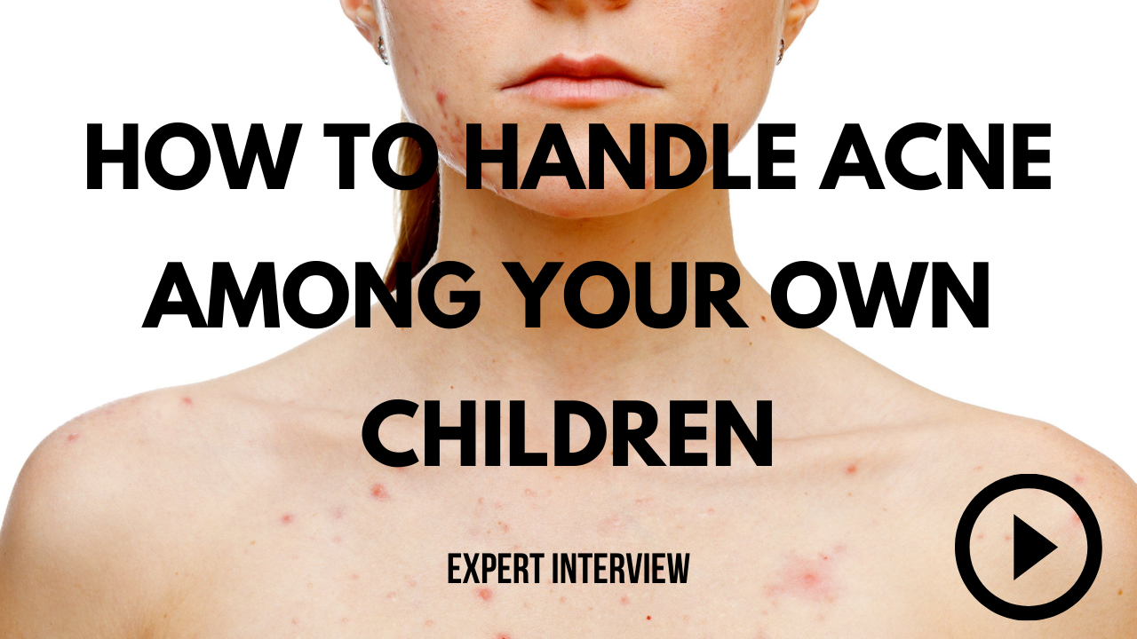 How to Handle Acne Among Your Own Children