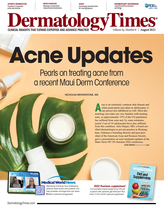 FDA Approves Roflumilast Cream 0.3% for Plaque Psoriasis FDA Approves Roflumilast Cream 0.3% for Plaque Psoriasis