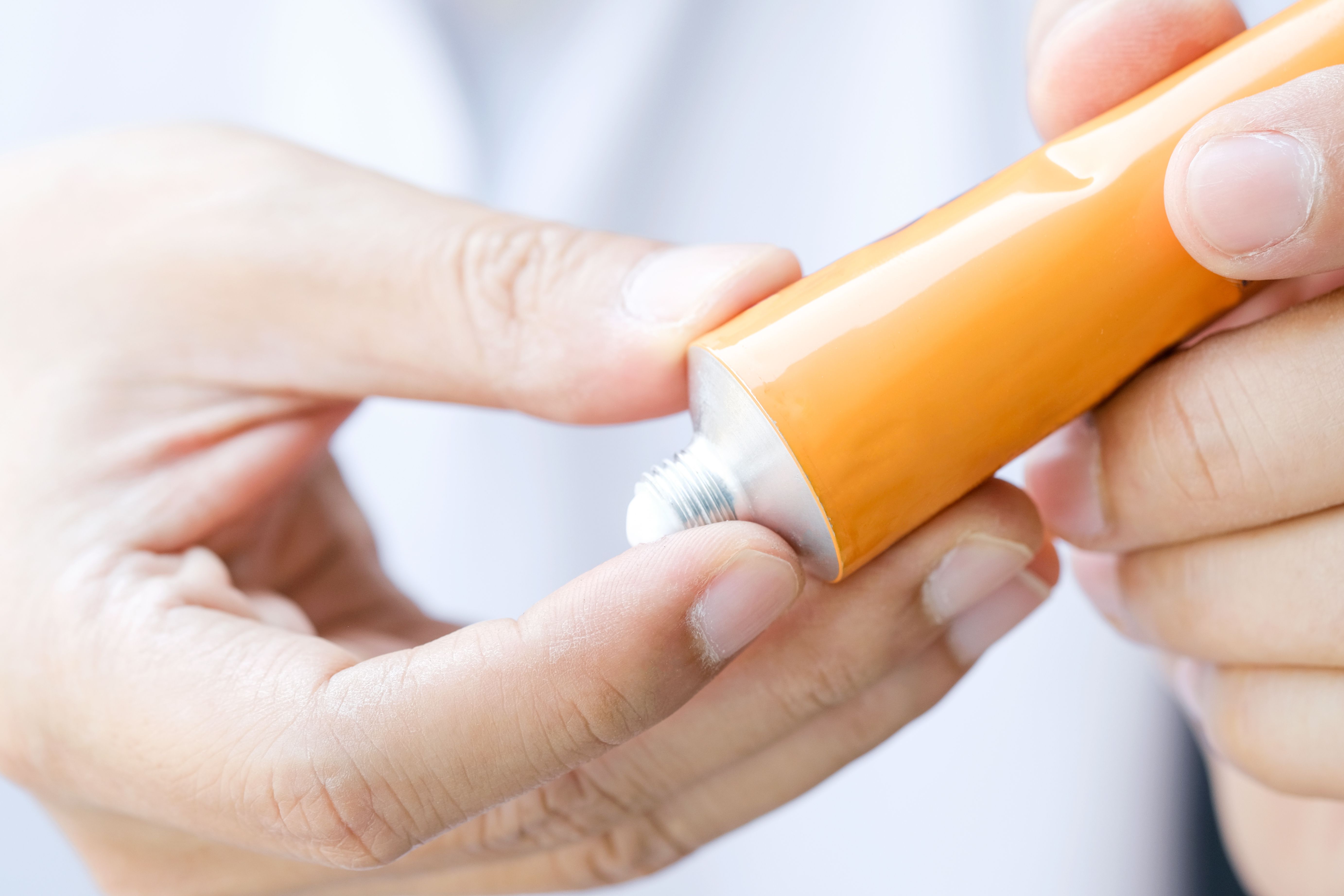 Navigating Topical Steroid Withdrawal and Extreme Adverse Reactions to ... Navigating Topical Steroid Withdrawal and Extreme Adverse Reactions to ...
