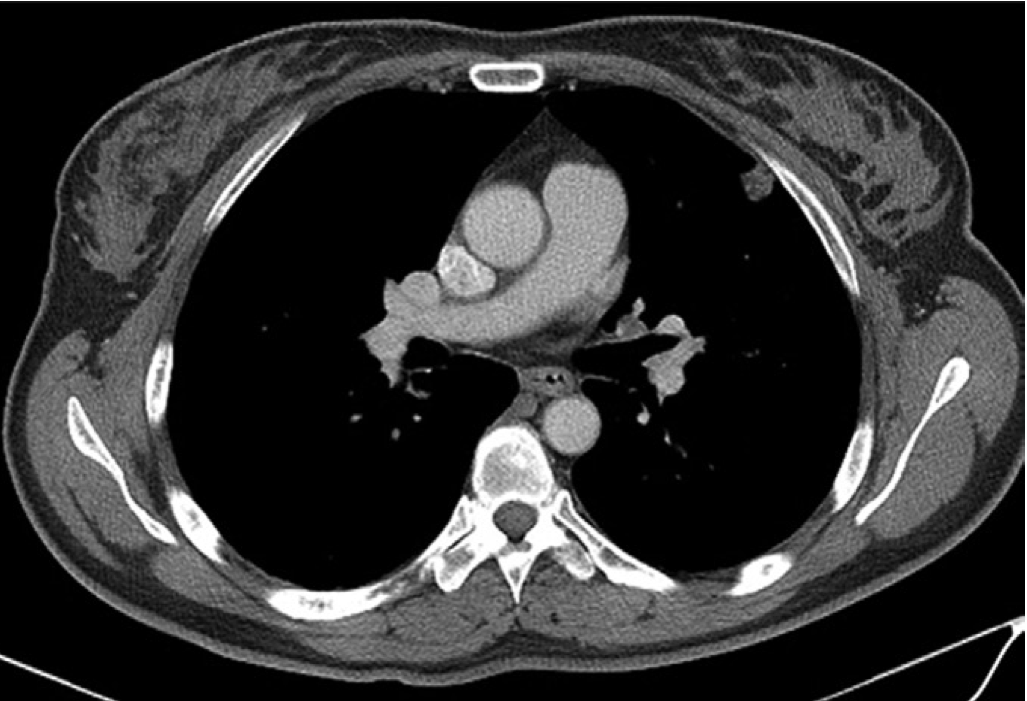 Radiologists Spot Chest X-ray Abnormalities Better with Deep-Learning ...