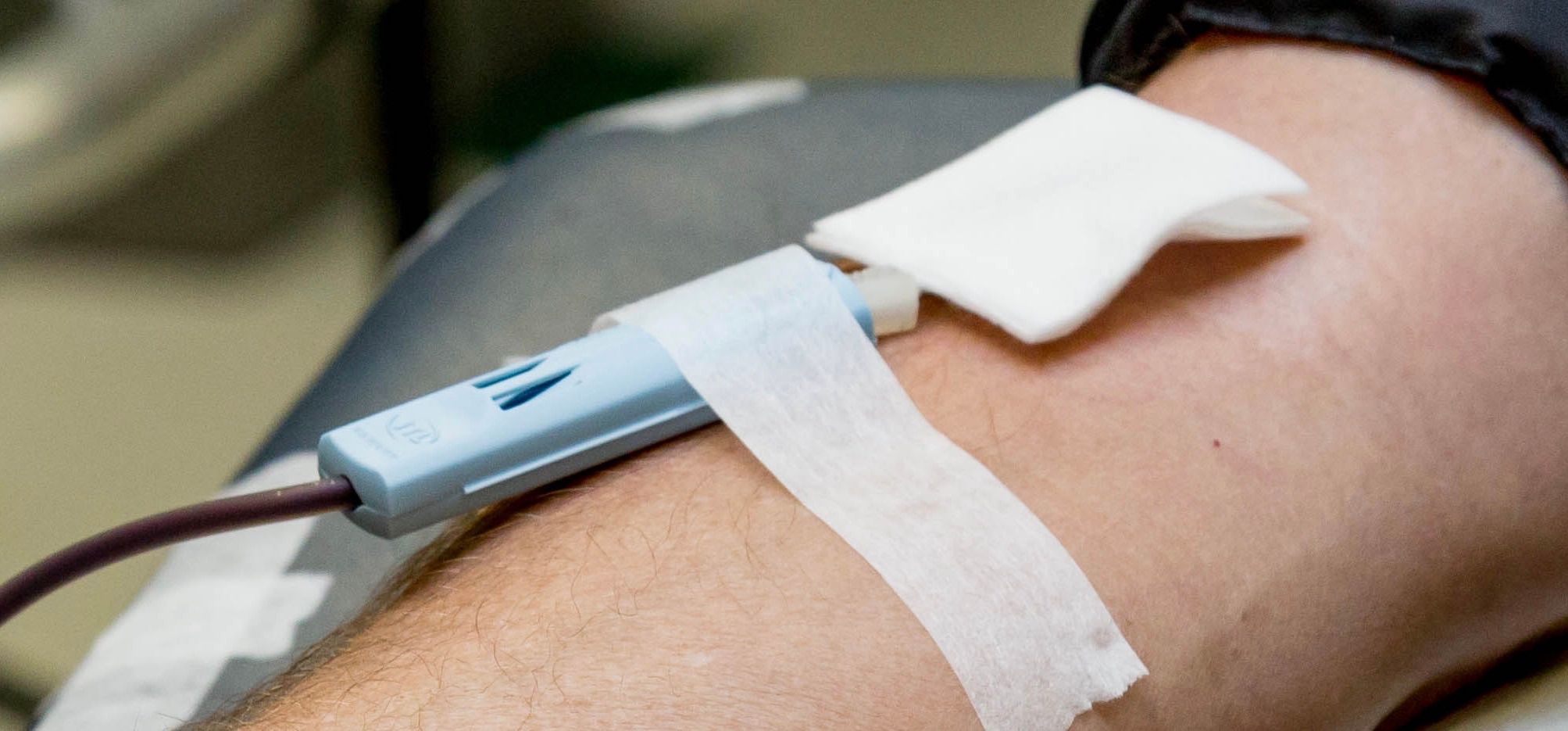 PICC Line Use Dropping Among Radiologists | Diagnostic Imaging