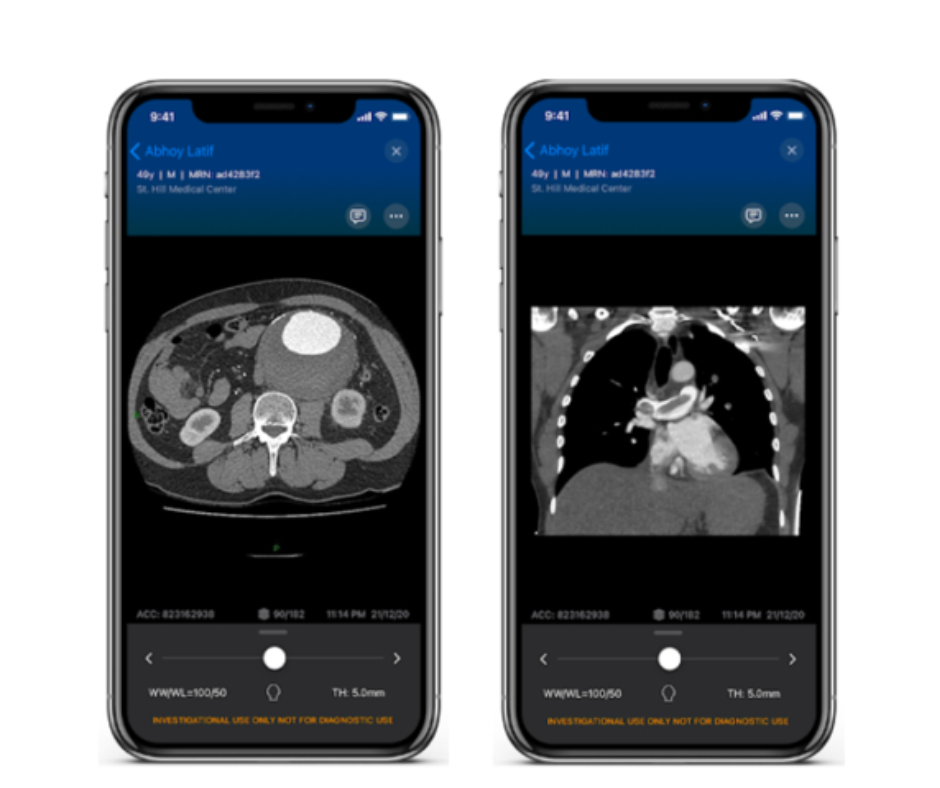 Viz.ai Launches AI-Powered Vascular Imaging Software