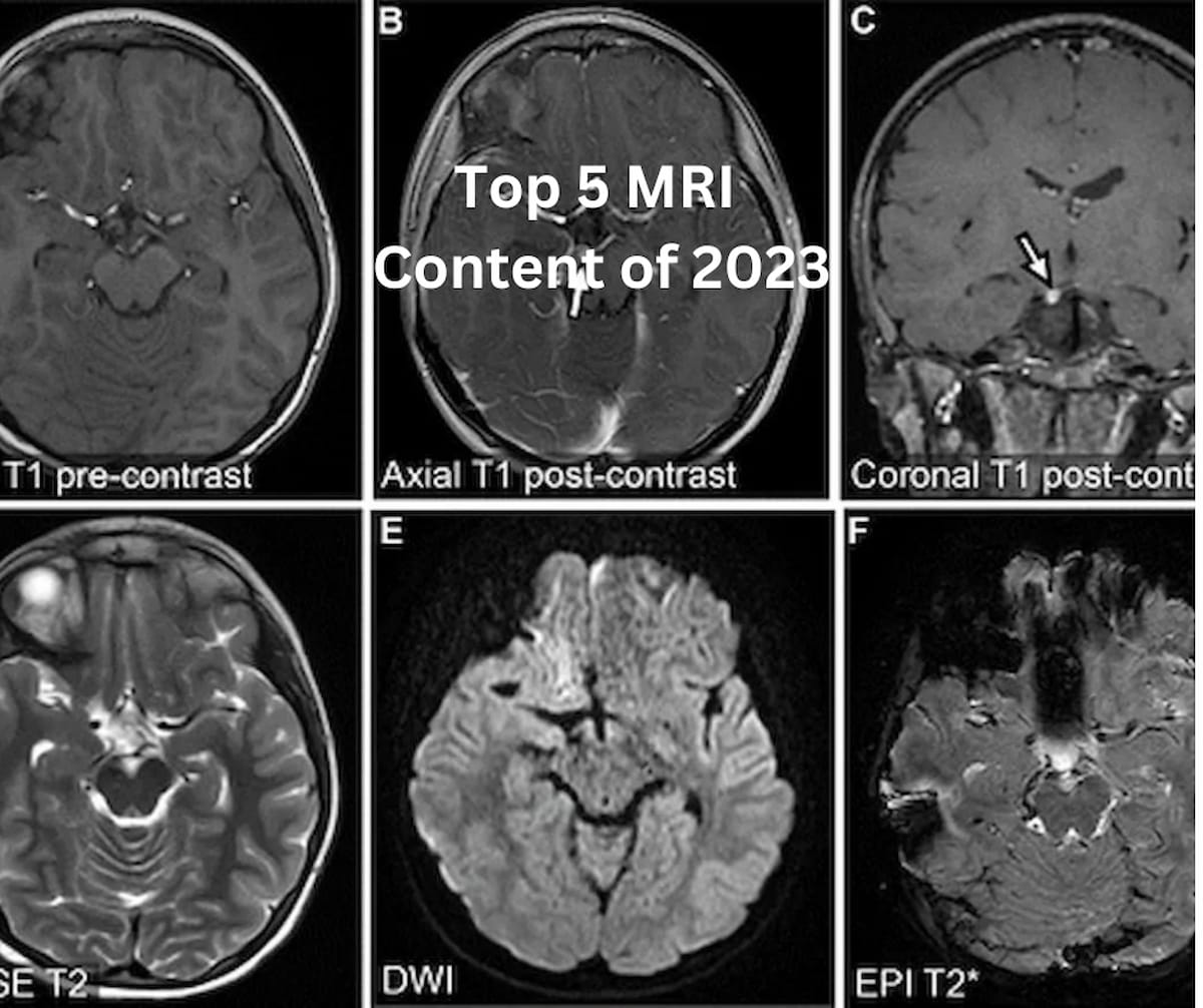 Top 5 MRI Content of 2023