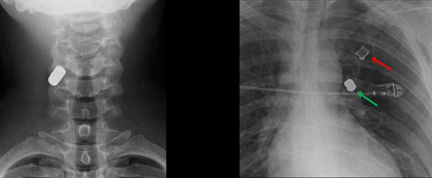 Imaging of Ballistic Injuries: Current and Emerging Insights