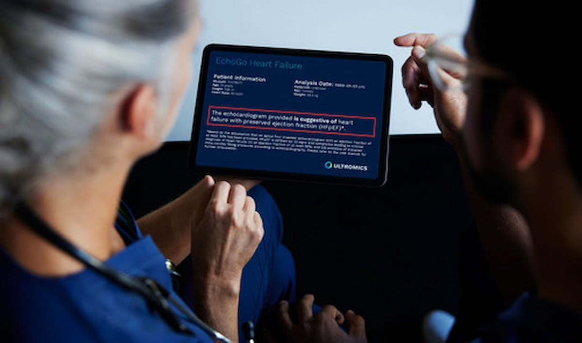 Ultromics Gets HCPCS Code for AI-Powered EchoGo Heart Failure Device