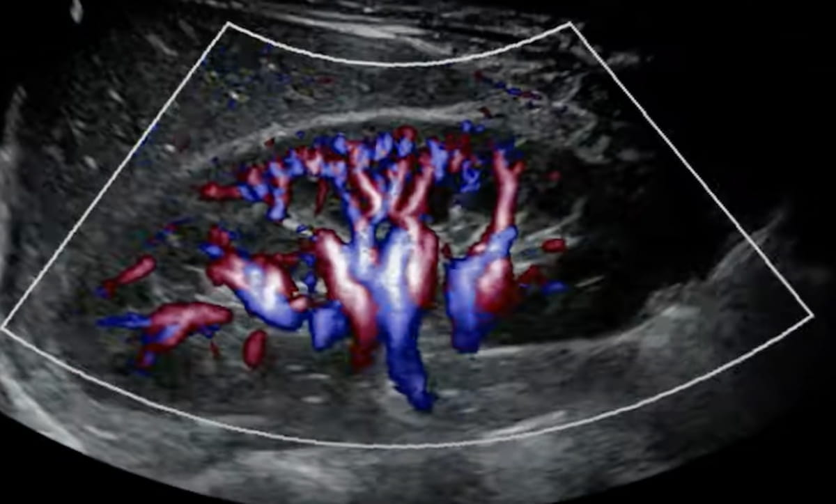 Mindray Debuts Resona A20 Premium Ultrasound Device at RSNA ...