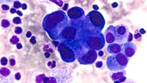 Virtual Biopsy: A Safer Future for Cancer Management