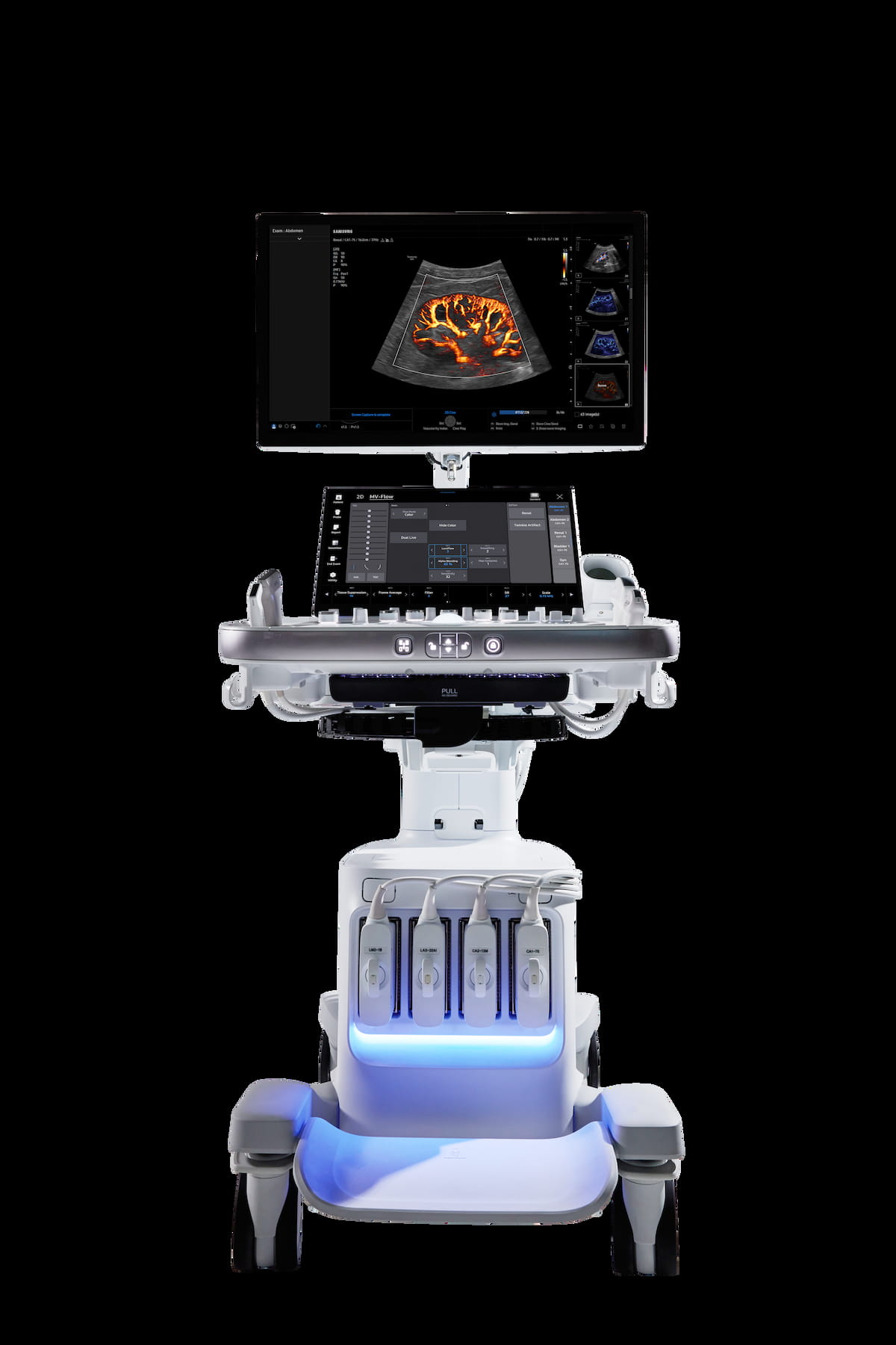 Samsung to Unveil AI-Powered R20 Ultrasound System at RSNA | Diagnostic ...