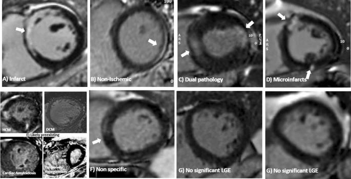Seven Takeaways from New Consensus Recommendations for Cardiac MRI ... Seven Takeaways from New Consensus Recommendations for Cardiac MRI ...